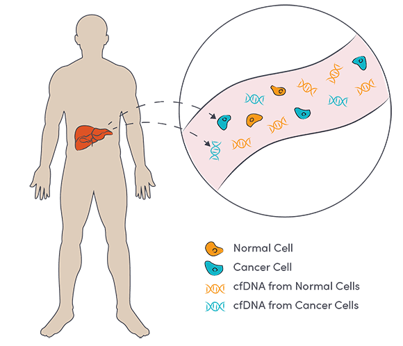 HelioLiver | Liver Cancer Detection | Helio Genomics