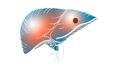 HelioLiver | Liver Cancer Detection | Helio Genomics
