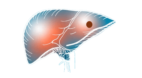 HelioLiver | Liver Cancer Detection | Helio Genomics